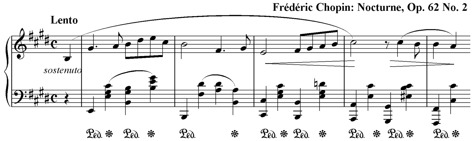 Paul Klee and Musical Polyphony – Robert Najlis